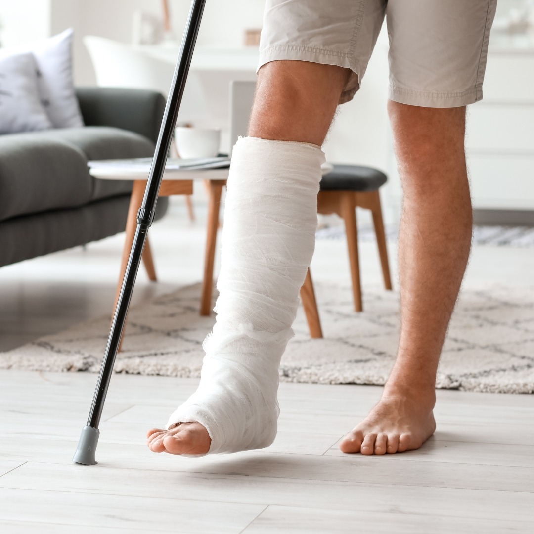 Fracture Injuries After a Car Accident | Blog